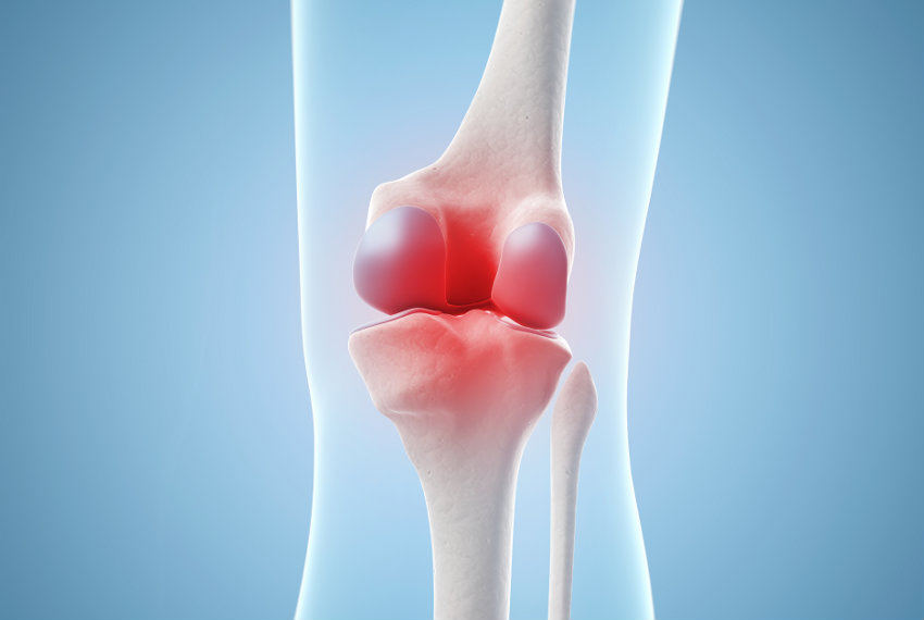 ACCUEIL - Institut Chirurgie Orthopédique Nantes Atlantique